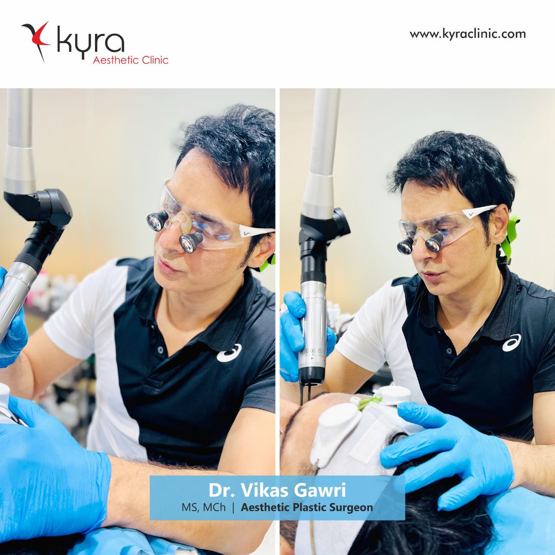 Laser Treatment - Cosmetic Surgery in Ludhiana, Plastic Surgery in ...